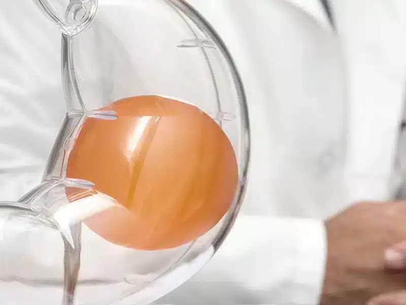 Stomach Balloon - Linden Clinics